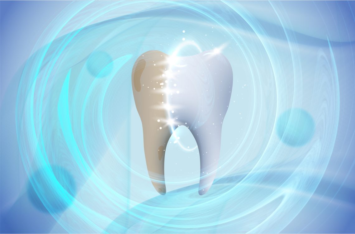 Why Do I Have Tooth Enamel Problems?
